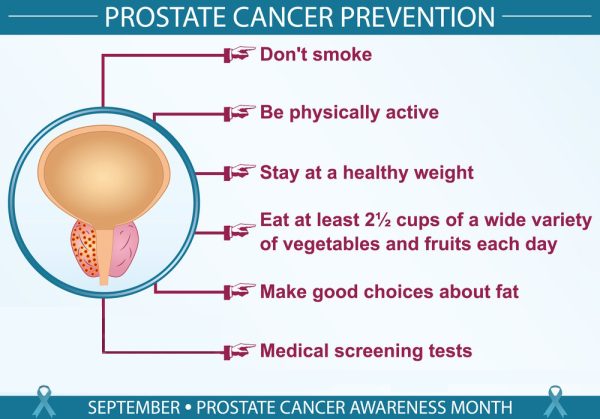 Effects of Finasteride on the Prostate Lyphar Provide Competitive Price